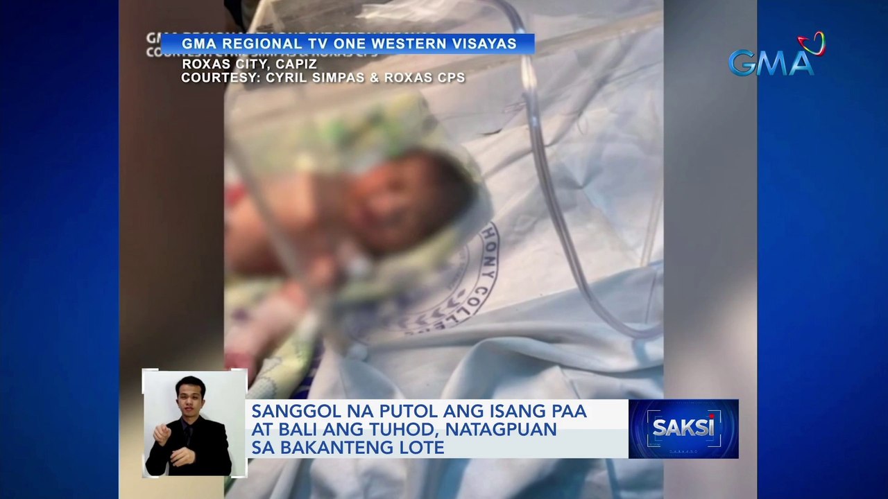 Sanggol na putol ang isang paa at bali ang tuhod, natagpuan sa ...