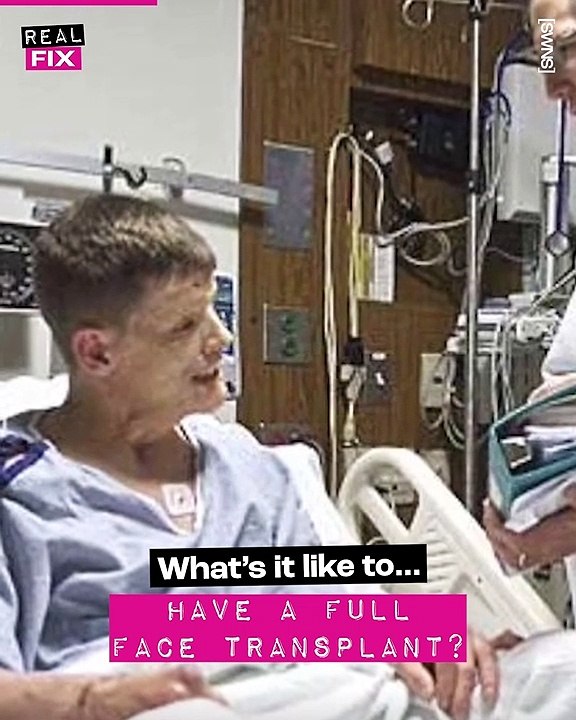 I have a full face transplant - video Dailymotion