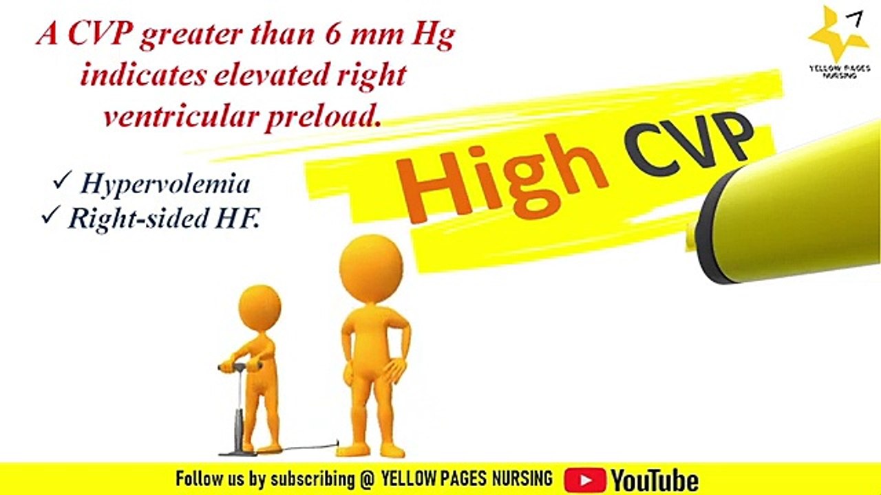 Central_Venous_Pressure_monitoring_|_CVP_monitoring_|_High_CVP_|_Low ...