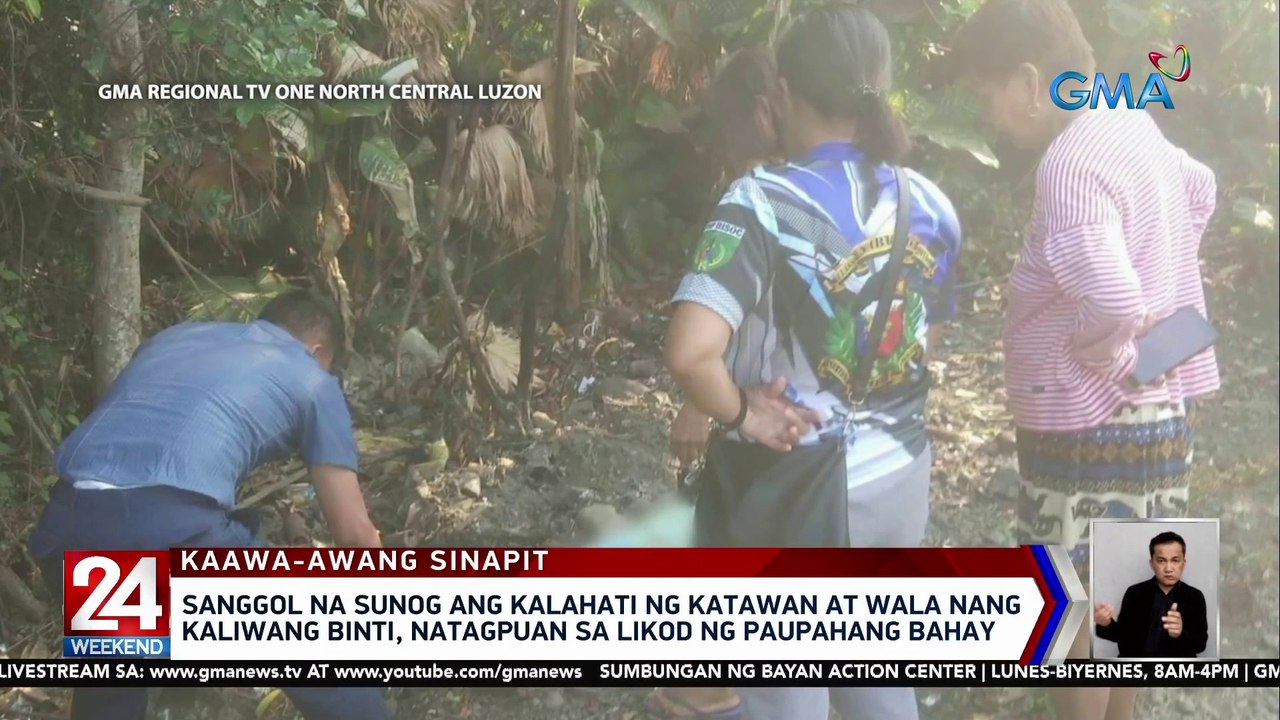 Sanggol na sunog ang kalahati ng katawan at wala nang kaliwang binti ...