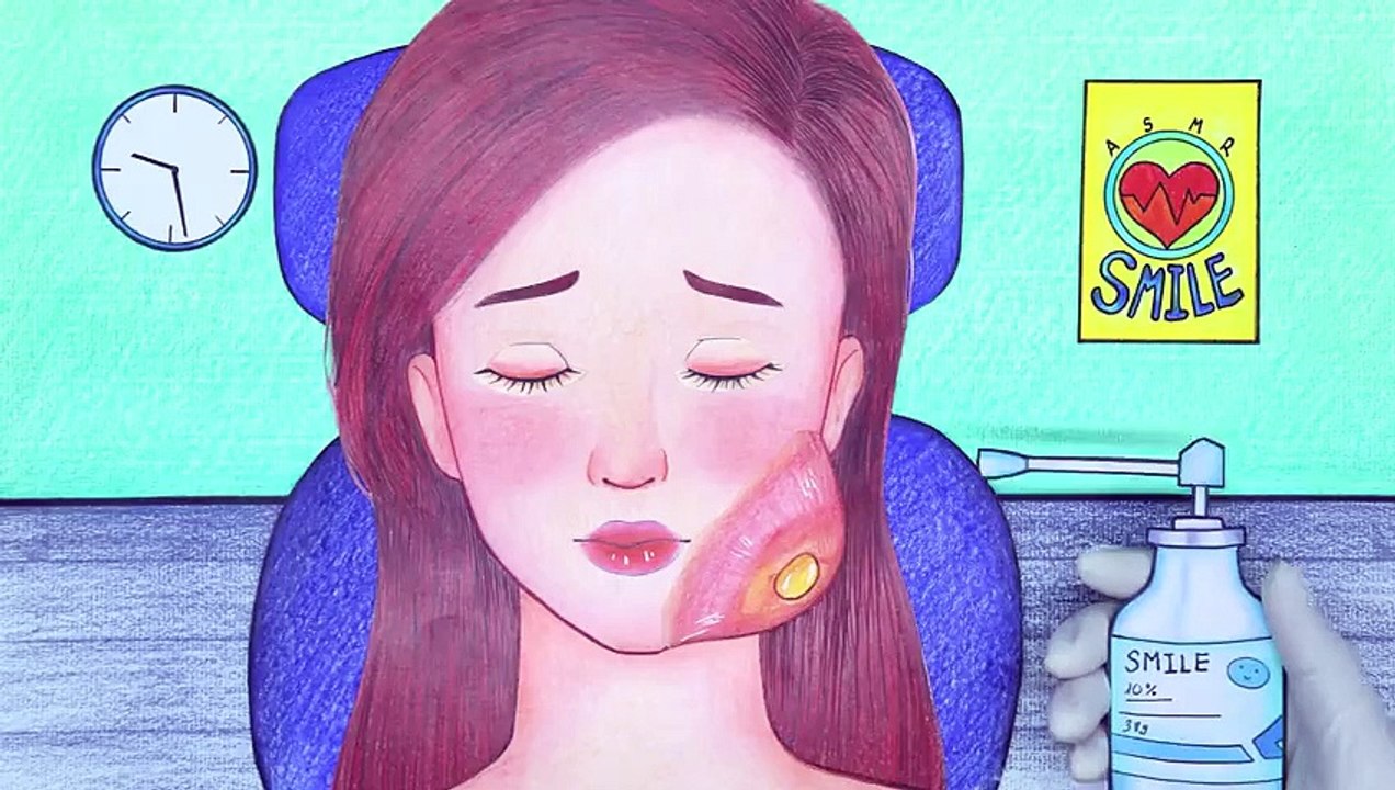 OMG! Ariel's Giant Abscess | ASMR Animation - video Dailymotion
