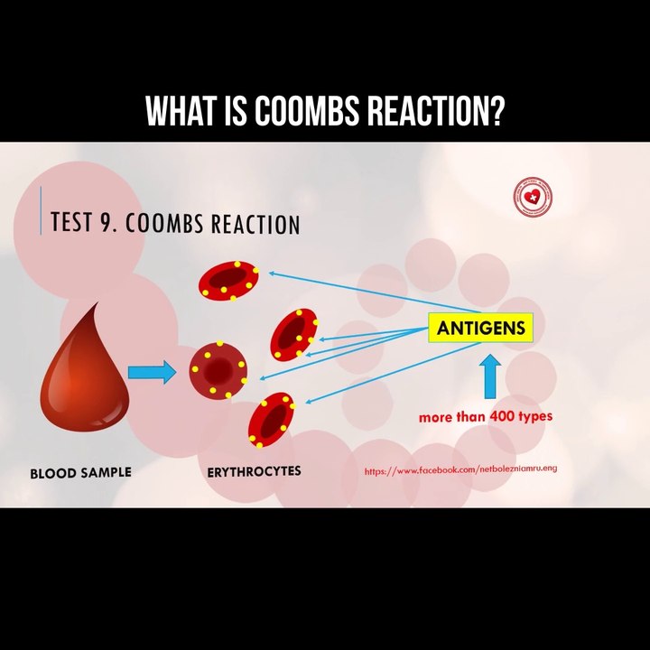 What is Coombs reaction? - video Dailymotion