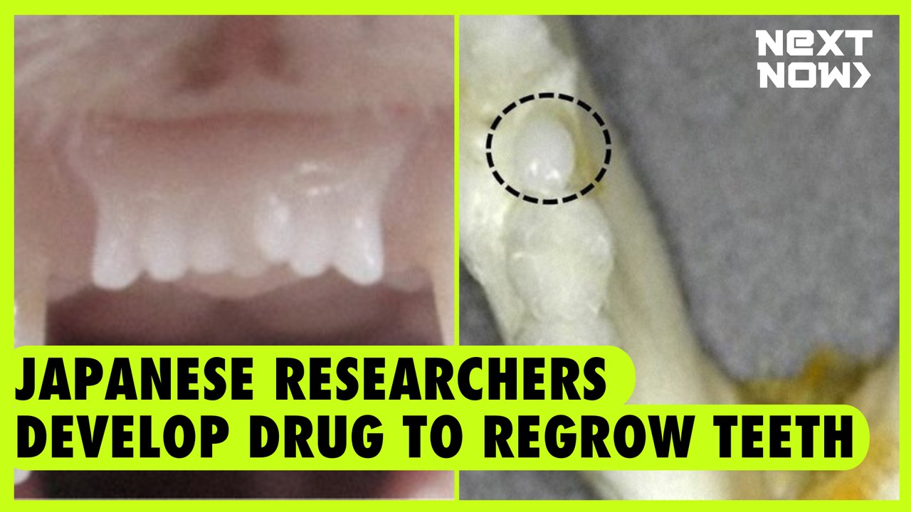 Japanese researchers develop drug to regrow teeth | NEXT NOW - video ...
