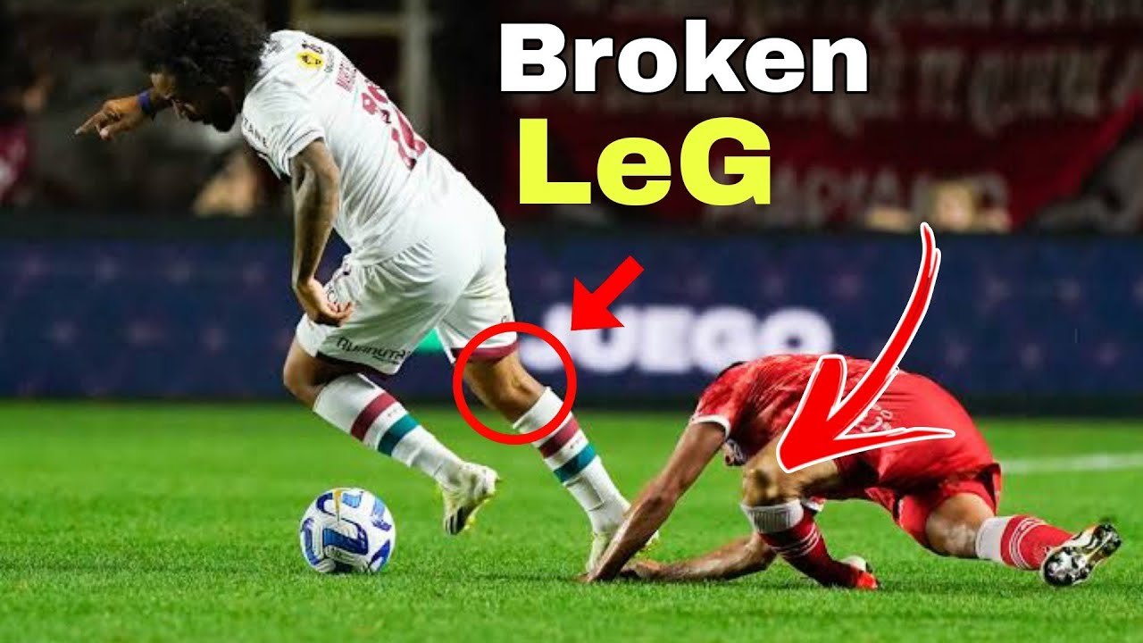 Marcelo vs Luciano Sánchez leg broken | Marcelo sent off after breaking ...