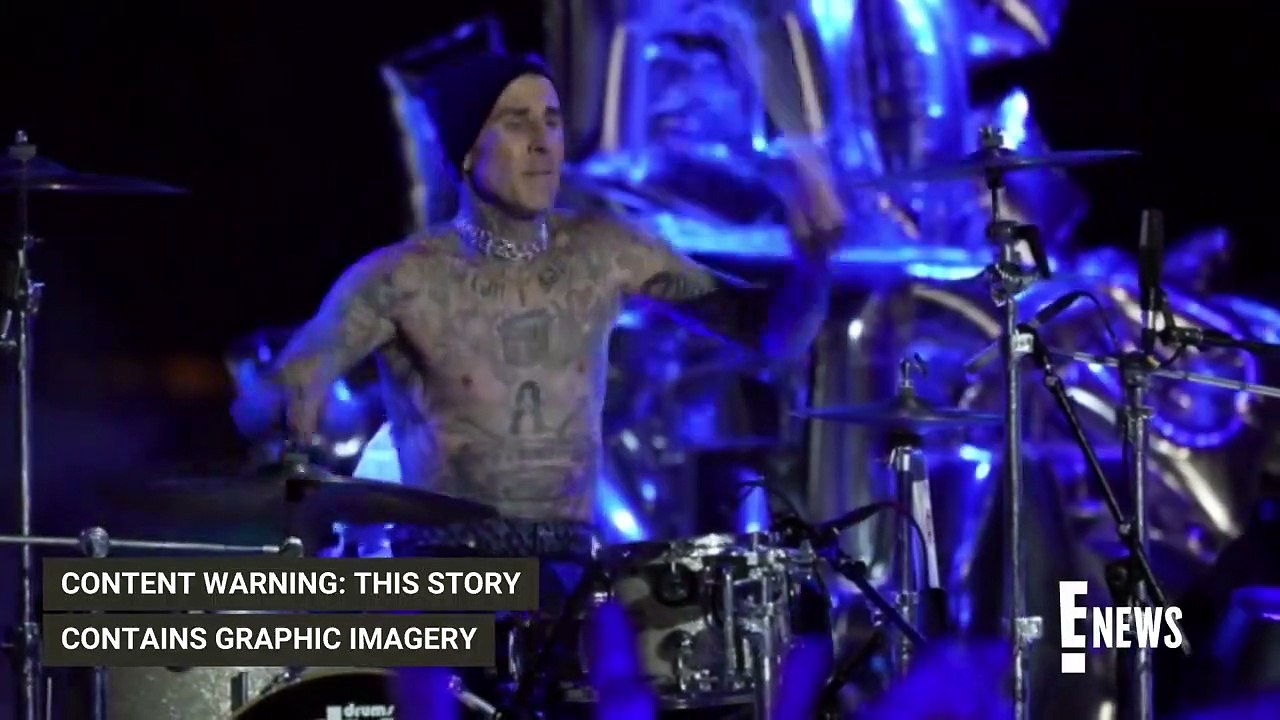Travis Barker Reveals a GRUESOME Hand Injury _ E! News - video Dailymotion