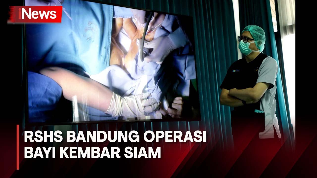 Hasan, Bayi Kembar Siam Meninggal Usai Opersasi Pemisahan di RSHS Bandung - Video Dailymotion