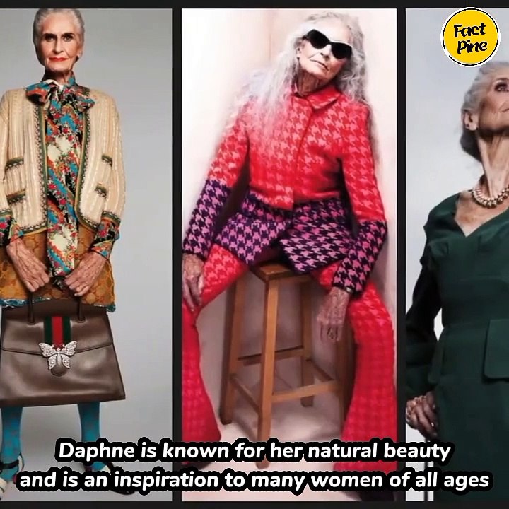 Breaking Beauty Norms: Meet 6 Unique Models Redefining Fashion ...