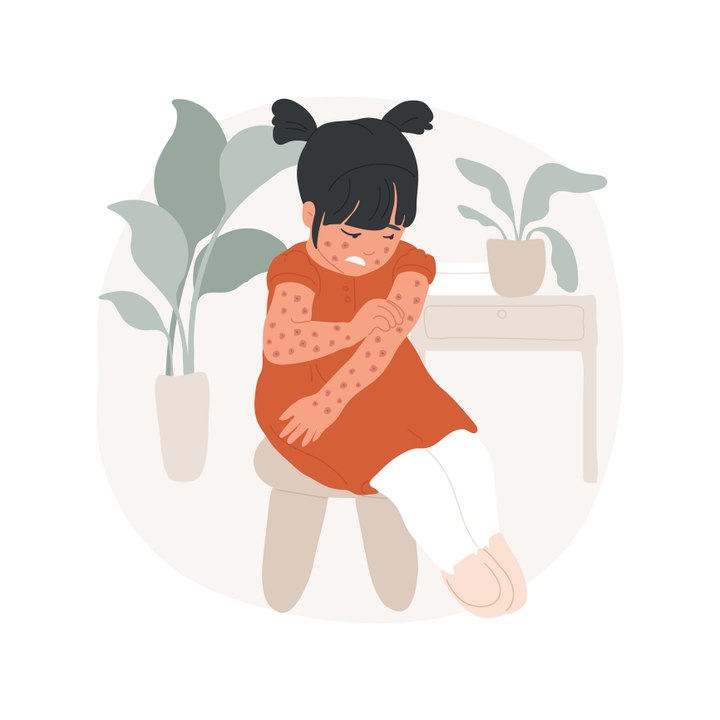 Fièvre, angine et éruption cutanée : les signes de la scarlatine ...