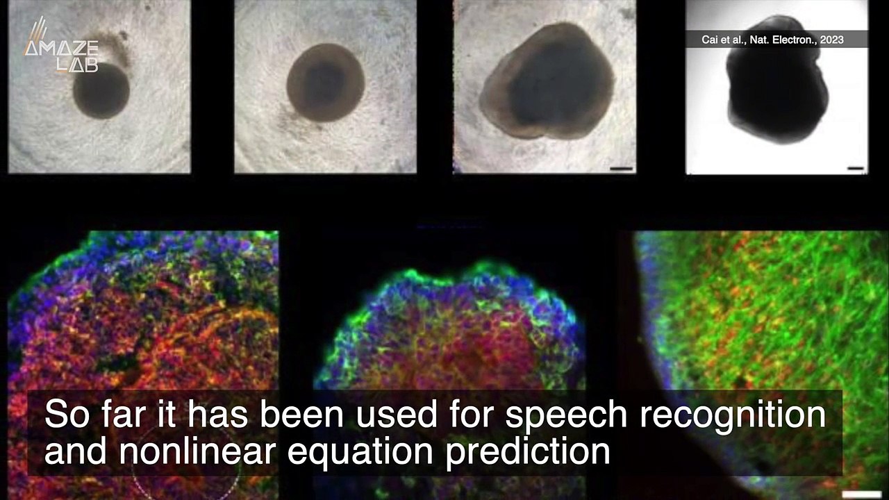 Scientists Produce Computer Made From Lab-Grown Human Brain Cells ...