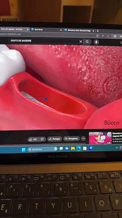 Voilà ce que je pense de la vidéo de Dr Sacha Gabriel - Vidéo Dailymotion