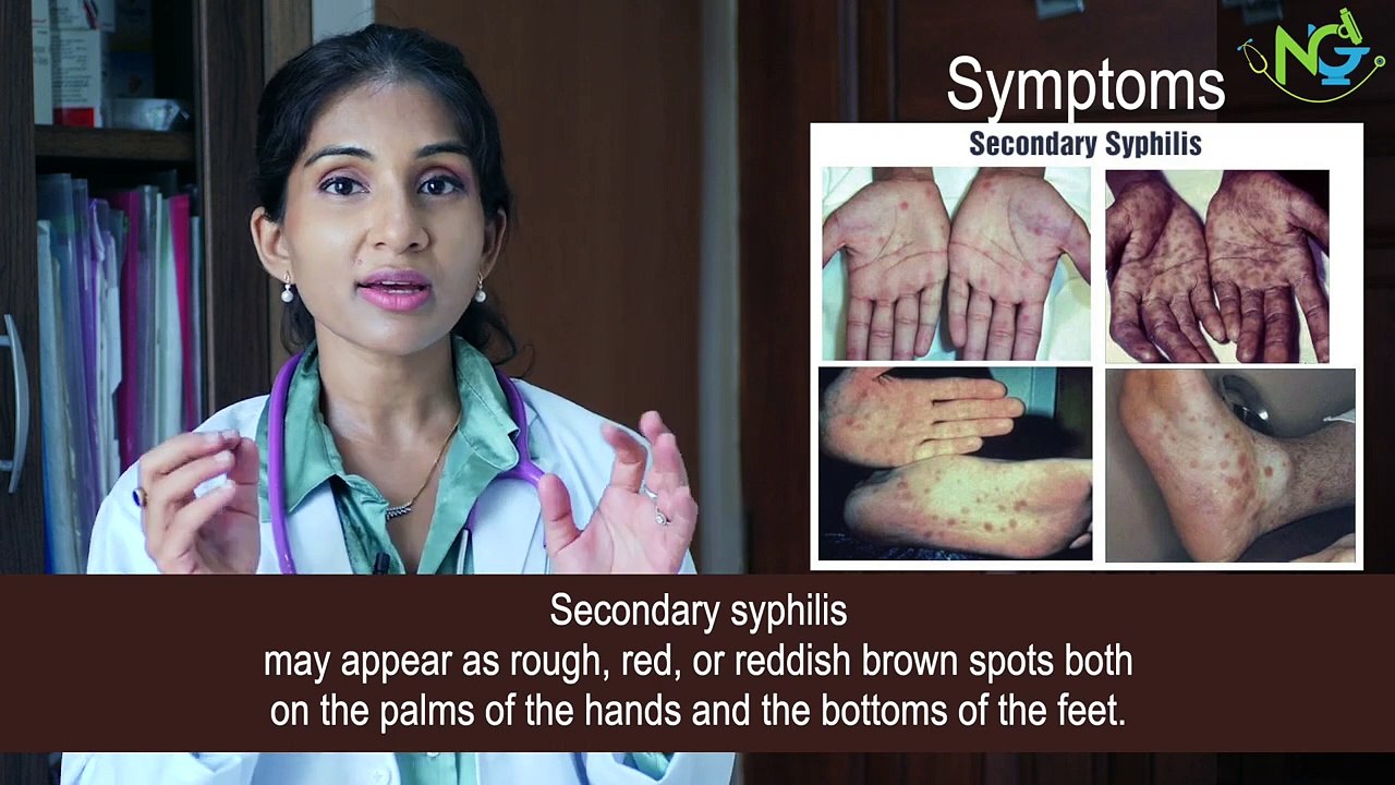 Understanding Syphilis - Symptoms I Diagnosis I Treatment - video ...