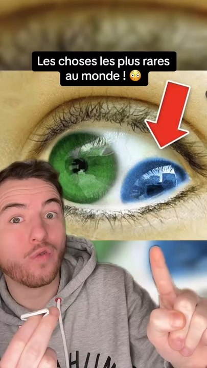 Les choses les plus rares au monde ! - Vidéo Dailymotion