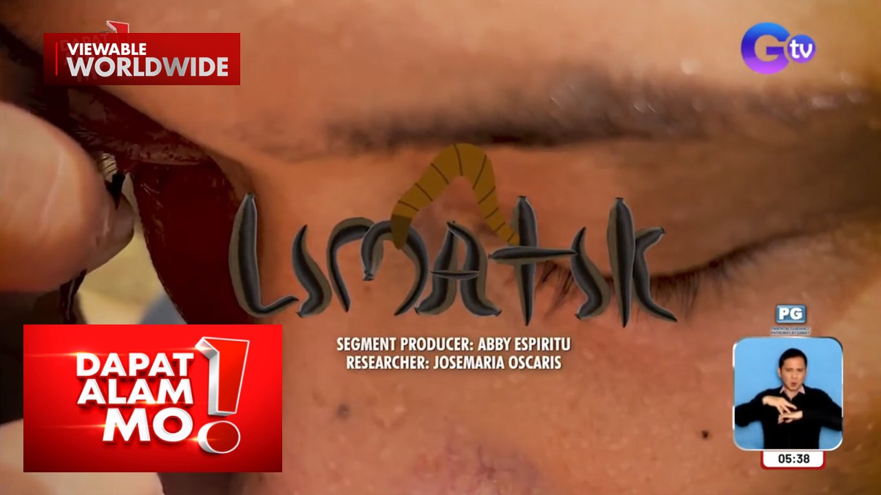 Ano ang dapat gawin kapag may dumikit na limatik sa iyong mata? | Dapat ...