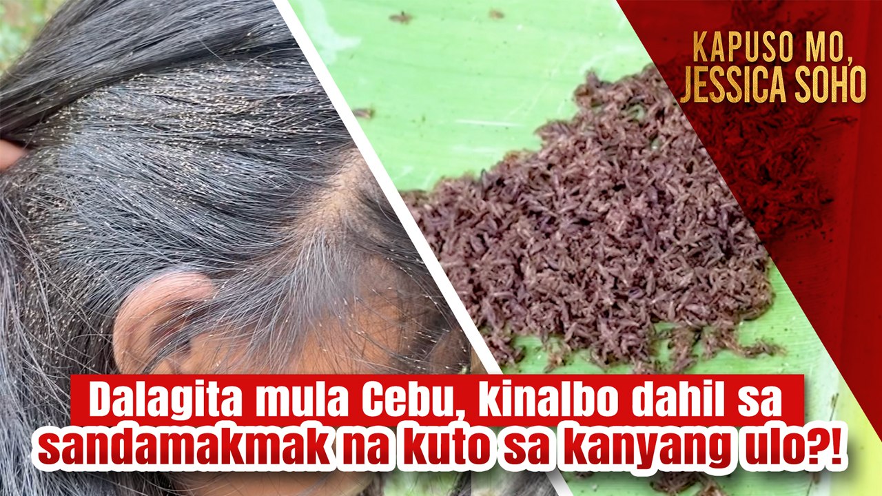 Dalagita mula Cebu, kinalbo dahil sa sandamakmak na kuto sa kanyang ulo?! | Kapuso Mo, Jessica ...