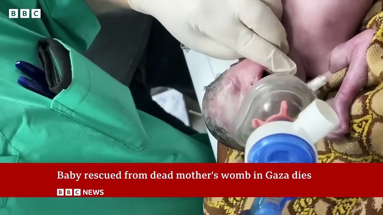 Baby saved from dead mother's womb in Gaza dies | BBC 2.0 News - video ...