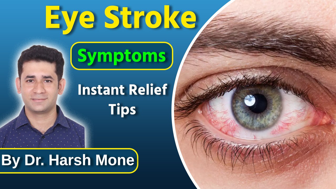 Eye Stroke Symptoms Risk and Treatment, Instant Relief Tips By Doctor ...