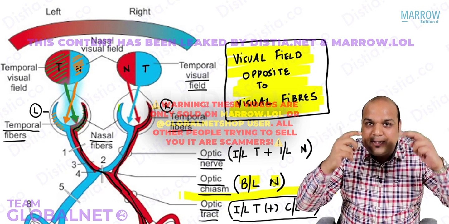 Neuro opthalmology - Visual pathway ,visual field defect yw ...