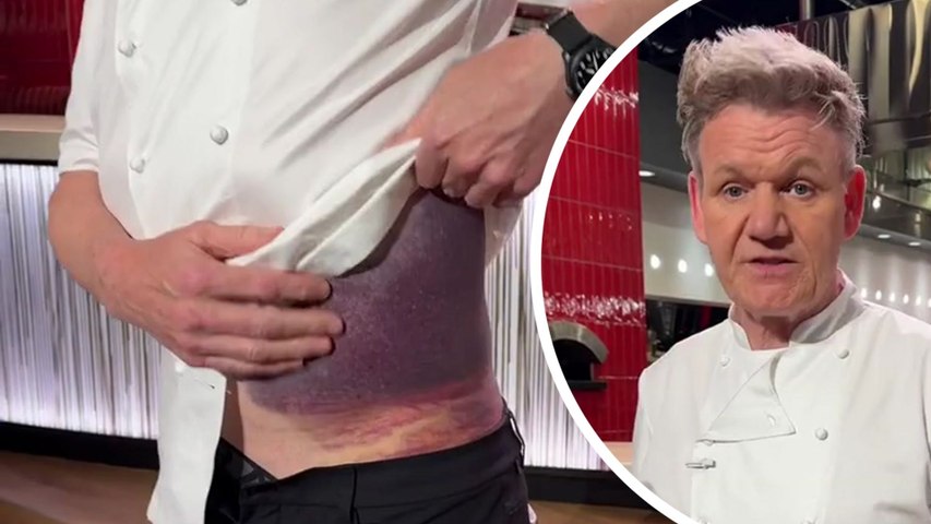 Gordon Ramsay 'lucky' to be alive after horrific bike accident | The ...