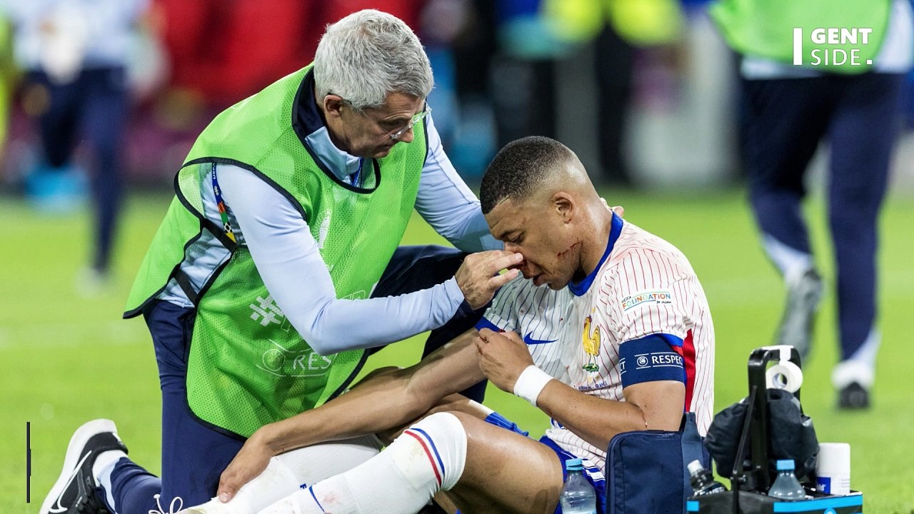 Nez cassé de Kylian Mbappé : quelles sont les nouvelles de son état de ...