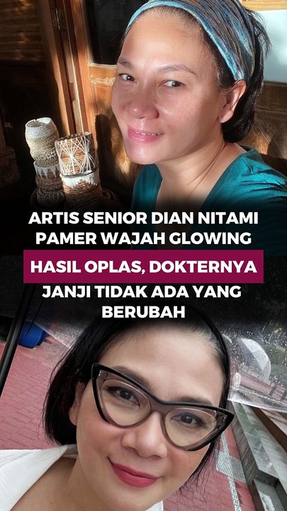 Artis senior Dian Nitami pamer wajah glowing hasil oplas, Dokternya janji tidak ada yang berubah ...