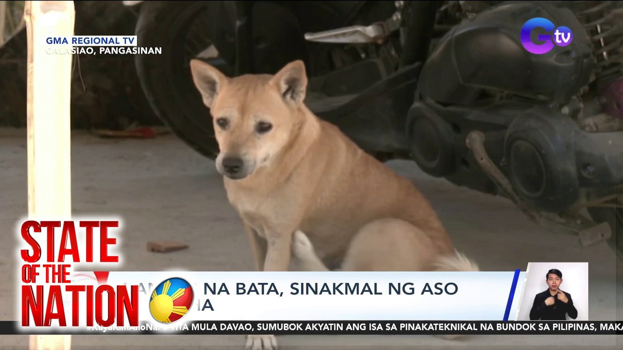 4-anyos na bata, sinakmal ng aso sa mukha | SONA - video Dailymotion