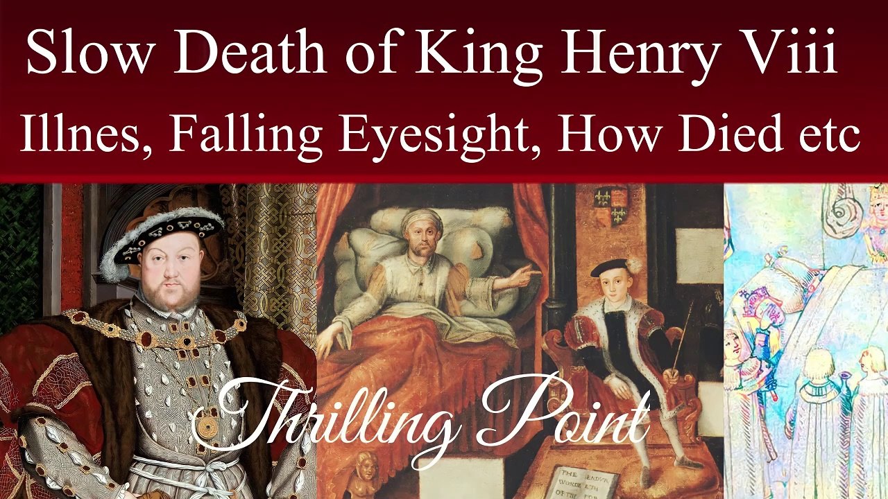 Slow death of Henry VIII | Henry VIII's illness | Henry viii death ...