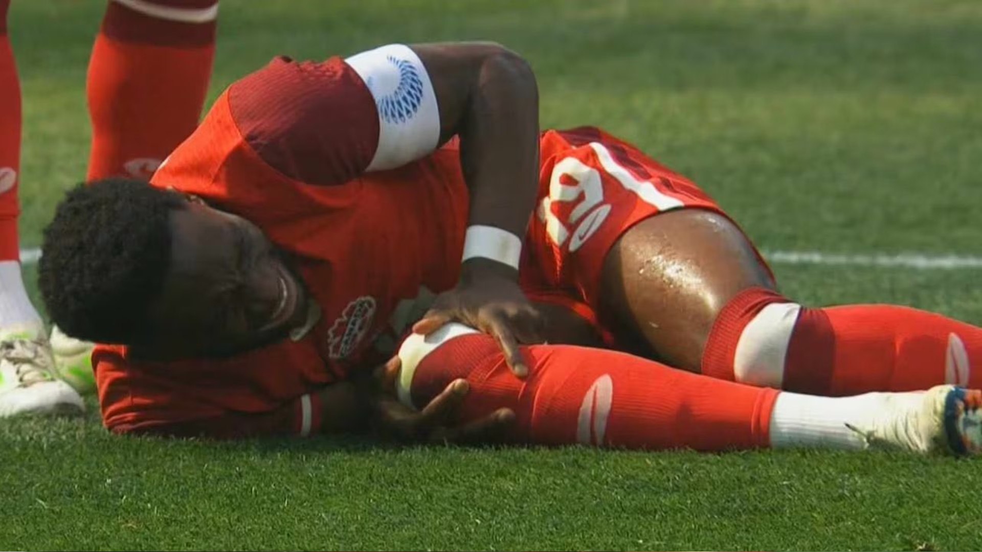 What Injury Does Alphonso Davies Have, and Will He Make It to the 2026 ...