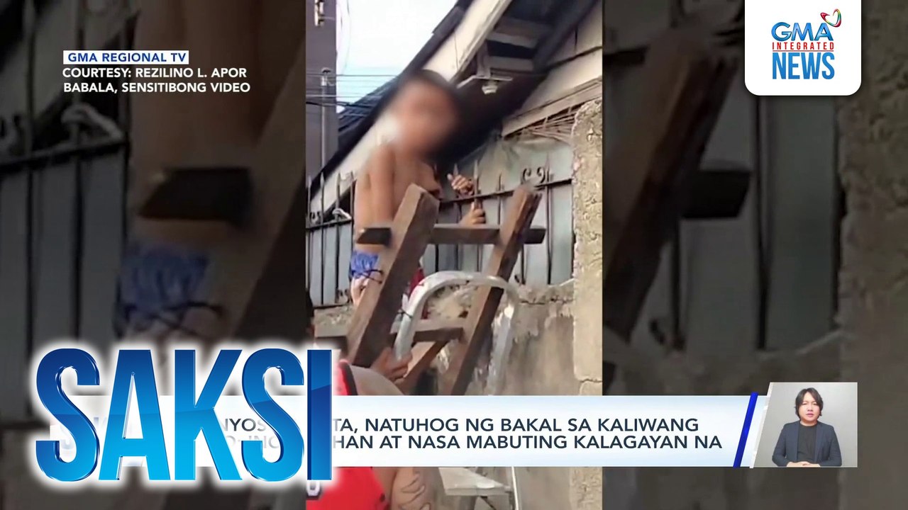 12-anyos na bata, natuhog ng bakal sa kaliwang braso; inoperahan at ...
