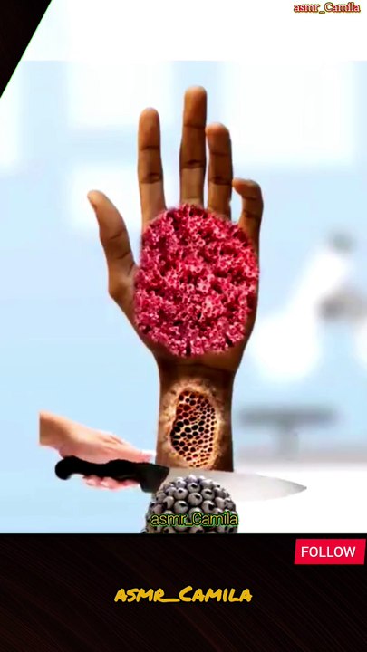 Women hand asmr animation treatment #trending #asmrsatisfying #shorts # ...