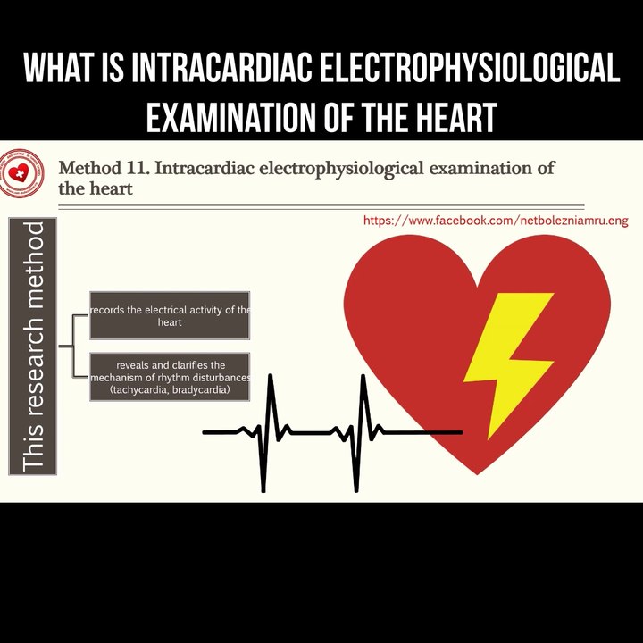 What is intracardiac electrophysiological examination of the heart ...