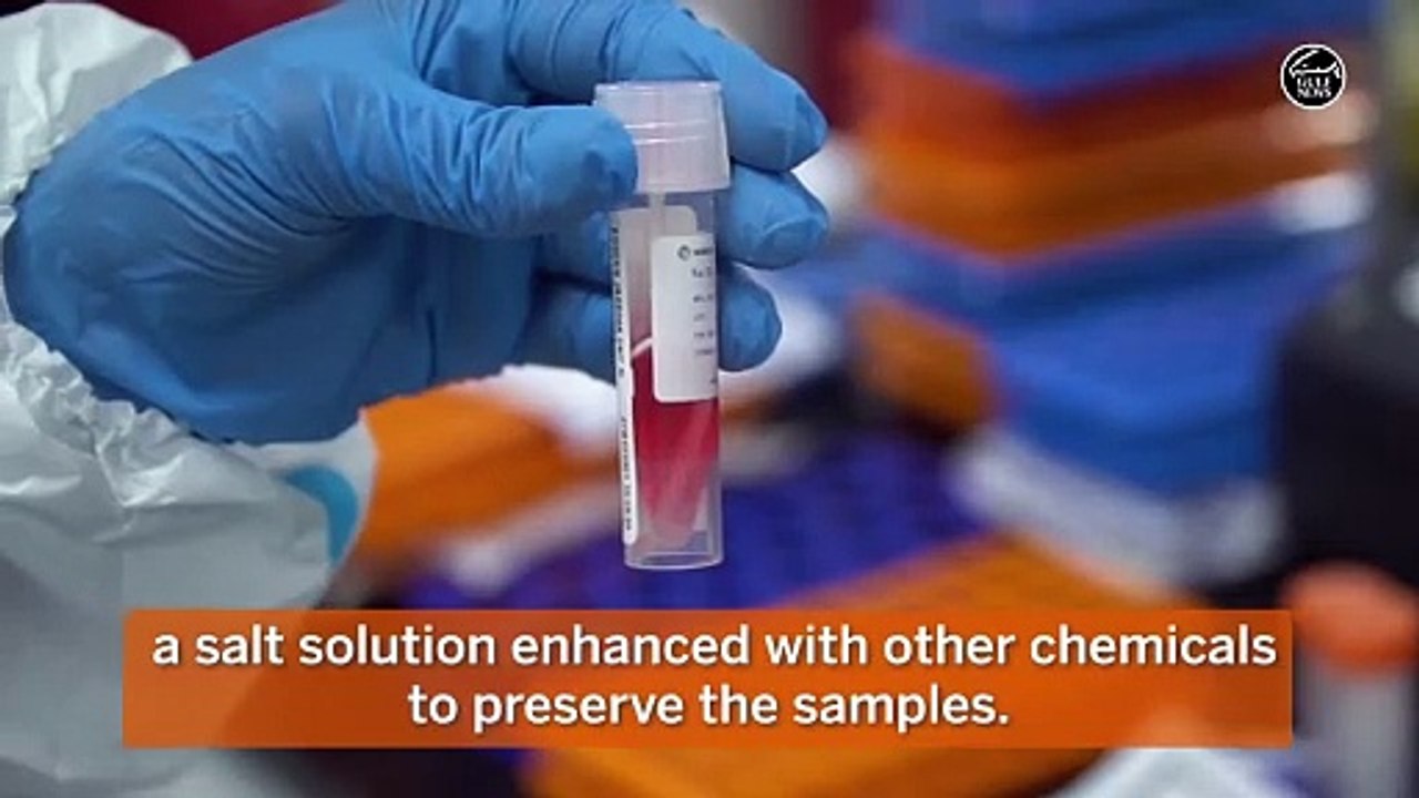 What happens to a PCR test sample when it is tested for COVID-19 ...