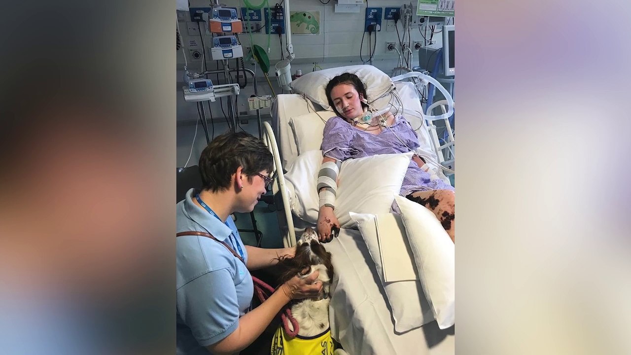 Medical student who lost limbs to meningitis has rare hand transplant ...