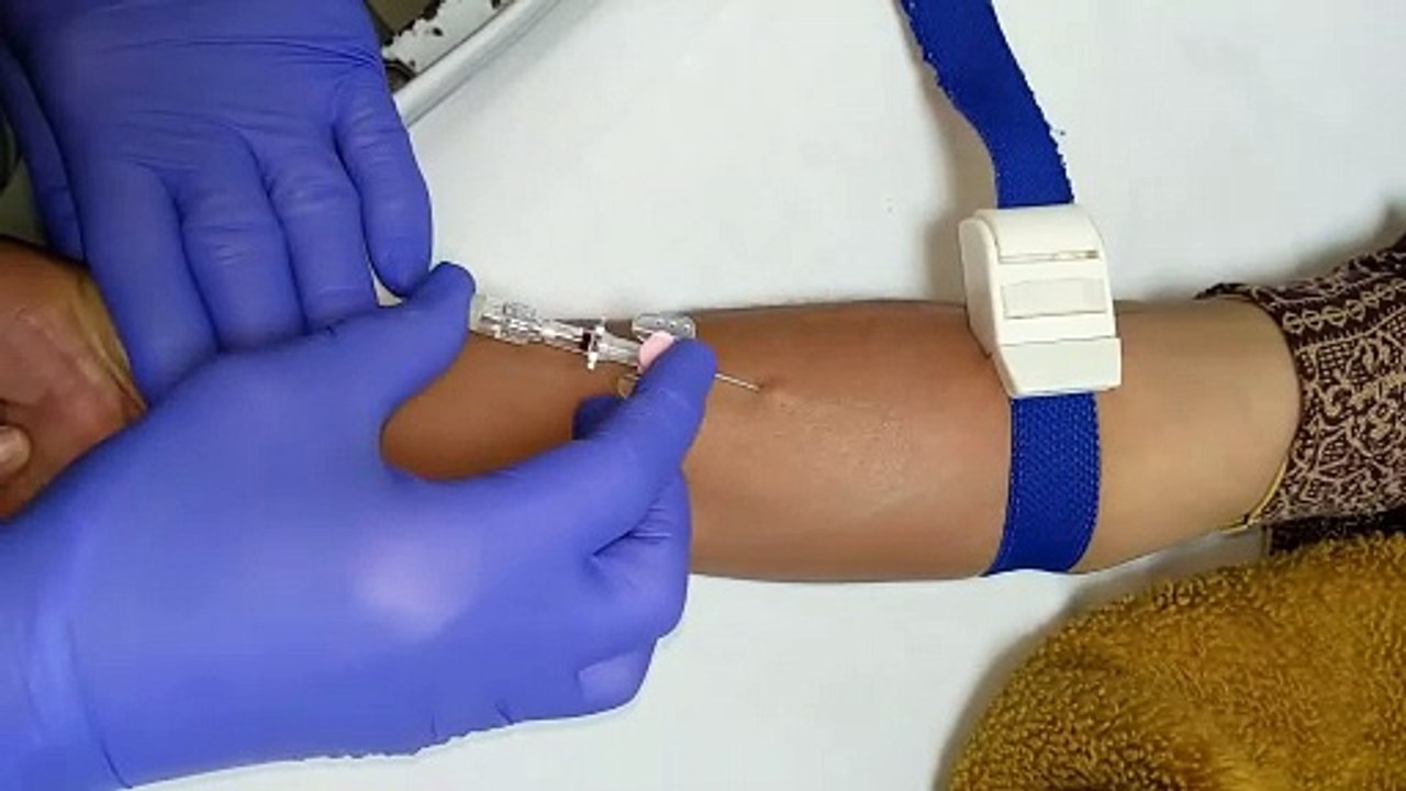 Intravenous cannula insertion techniques - video Dailymotion