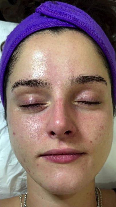 Facial Chelsea – Real Results, Real Glow! 💆‍♀️ - video Dailymotion