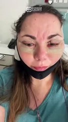 Facelift Surgery by Booking Surgery - Dailymotion