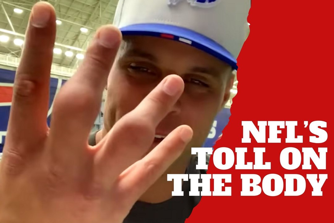 Bills Jordan Poyer shows how the NFL takes a brutal toll on the body ...