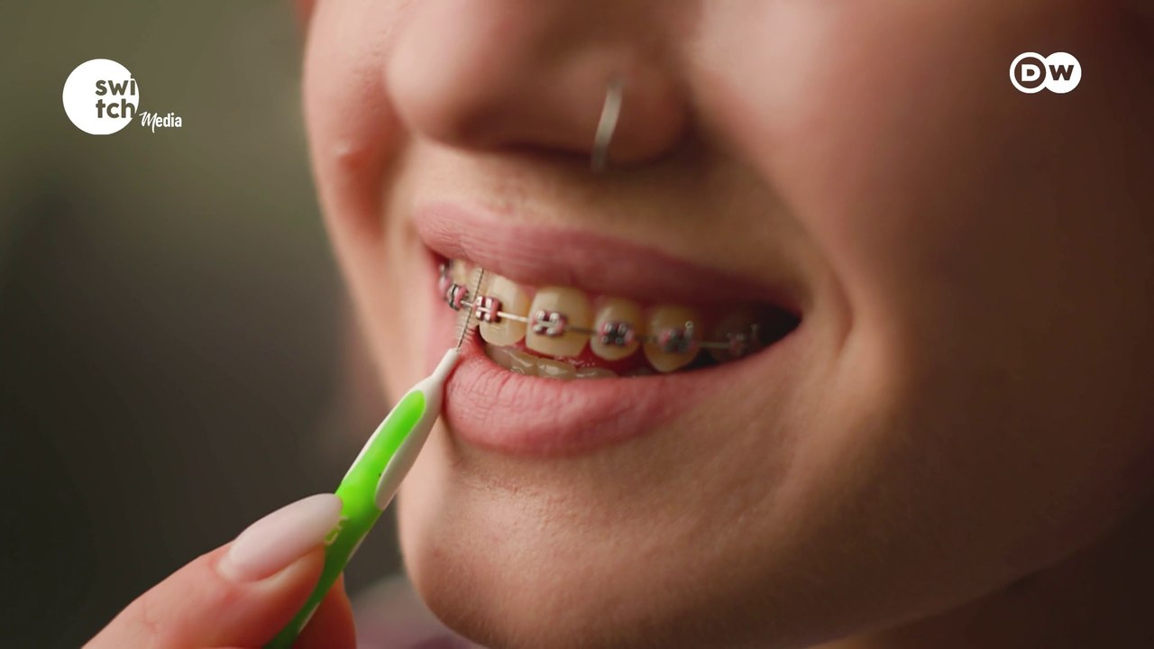In Good Shape: All about the dental formula - video Dailymotion