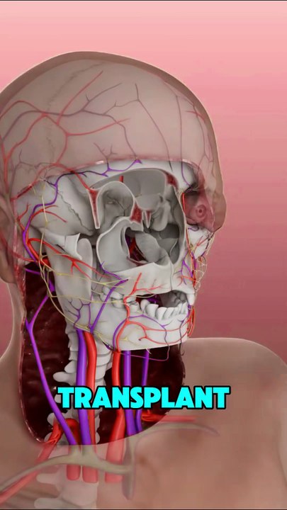 Face Transplant Surgery Explained | Procedure, Risks, Recovery ...