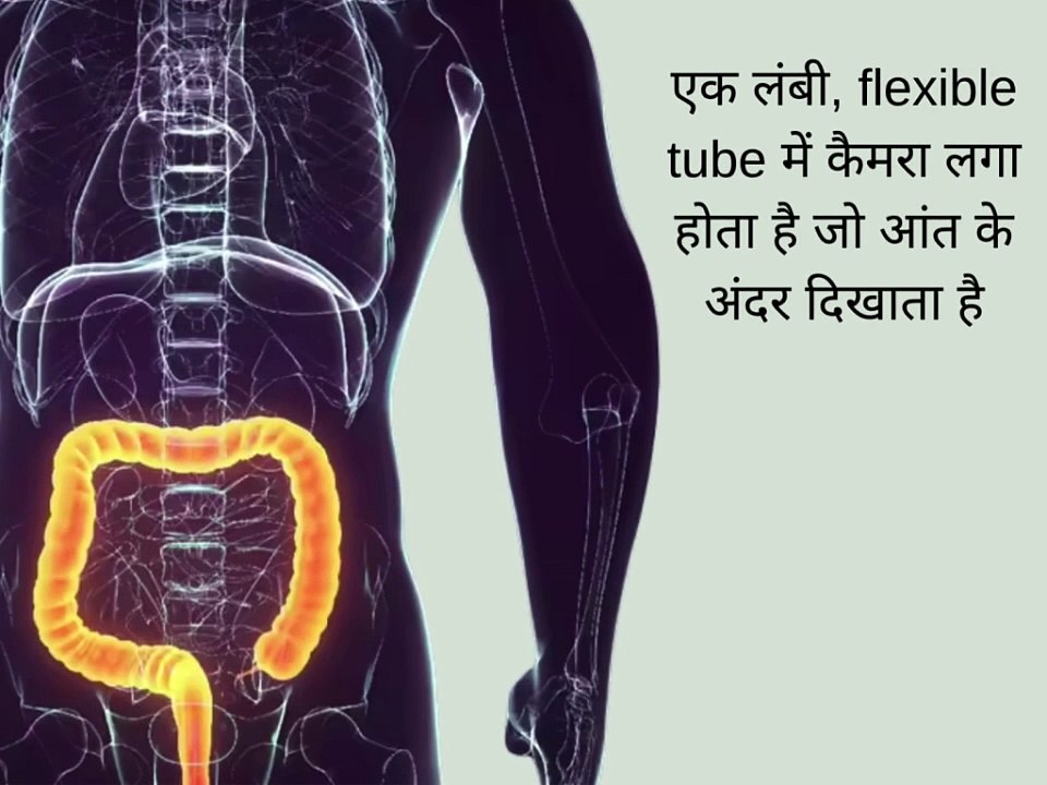 Understanding Colonoscopy: A Key Test for Colon Cancer Prevention ...