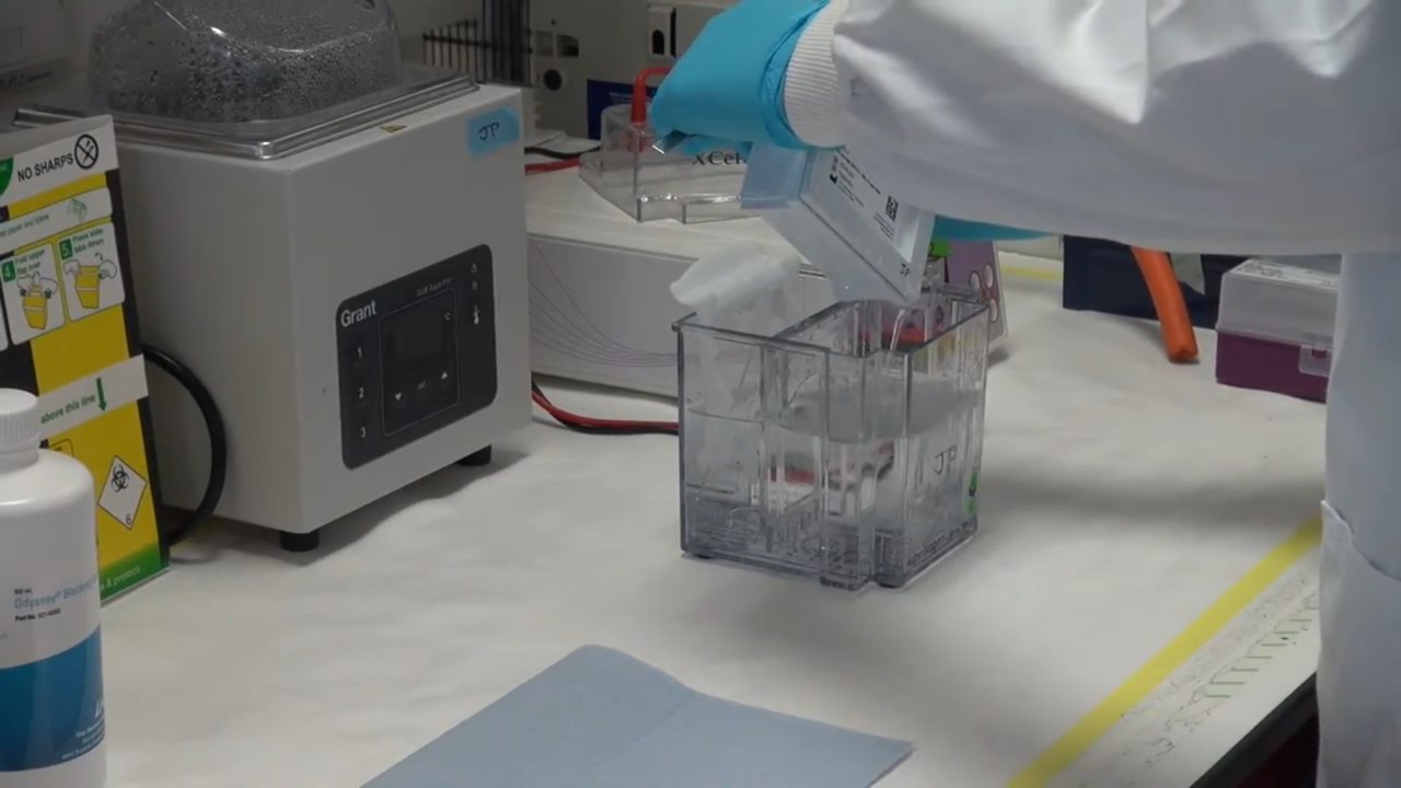 Cancer prevalence in Merseyside significantly above national average ...