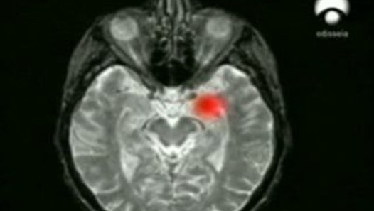 Musofobia (Fobia a ratones: RMf) - Vídeo Dailymotion